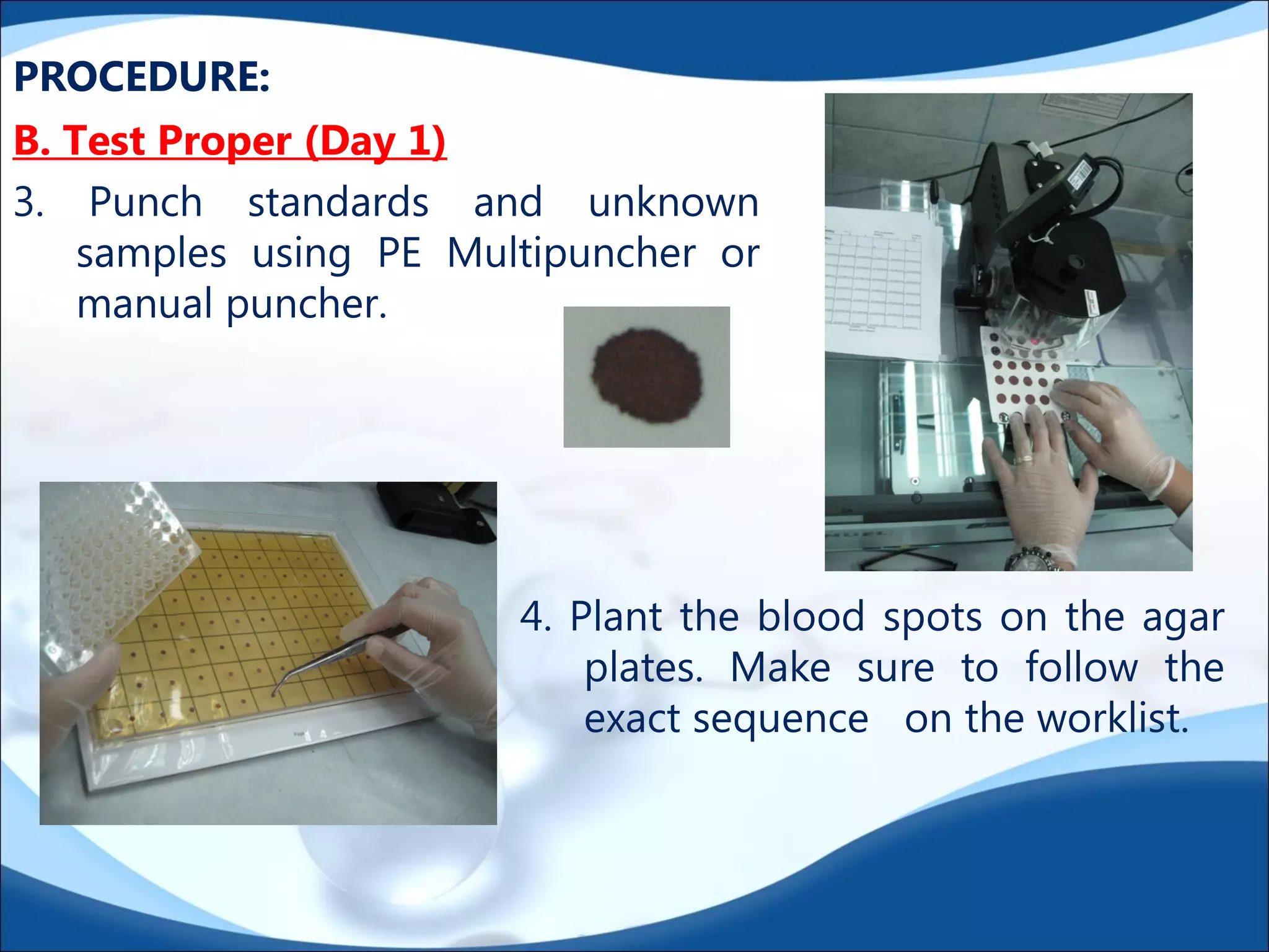 Laboratory procedure of bacterial inhibition assay | PPT