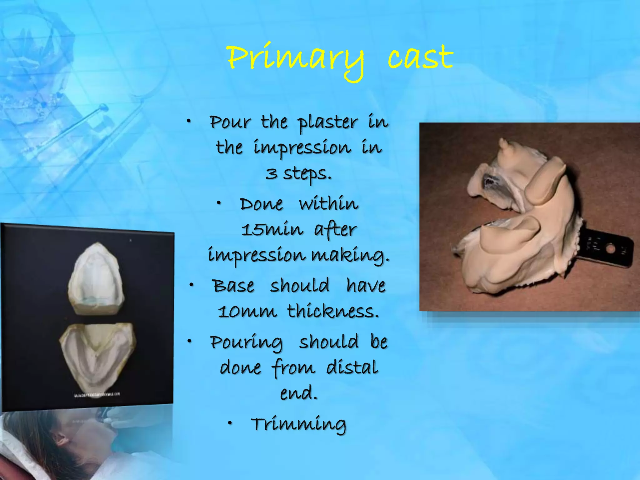 laboratory procedures in make of complete denture | PPTX