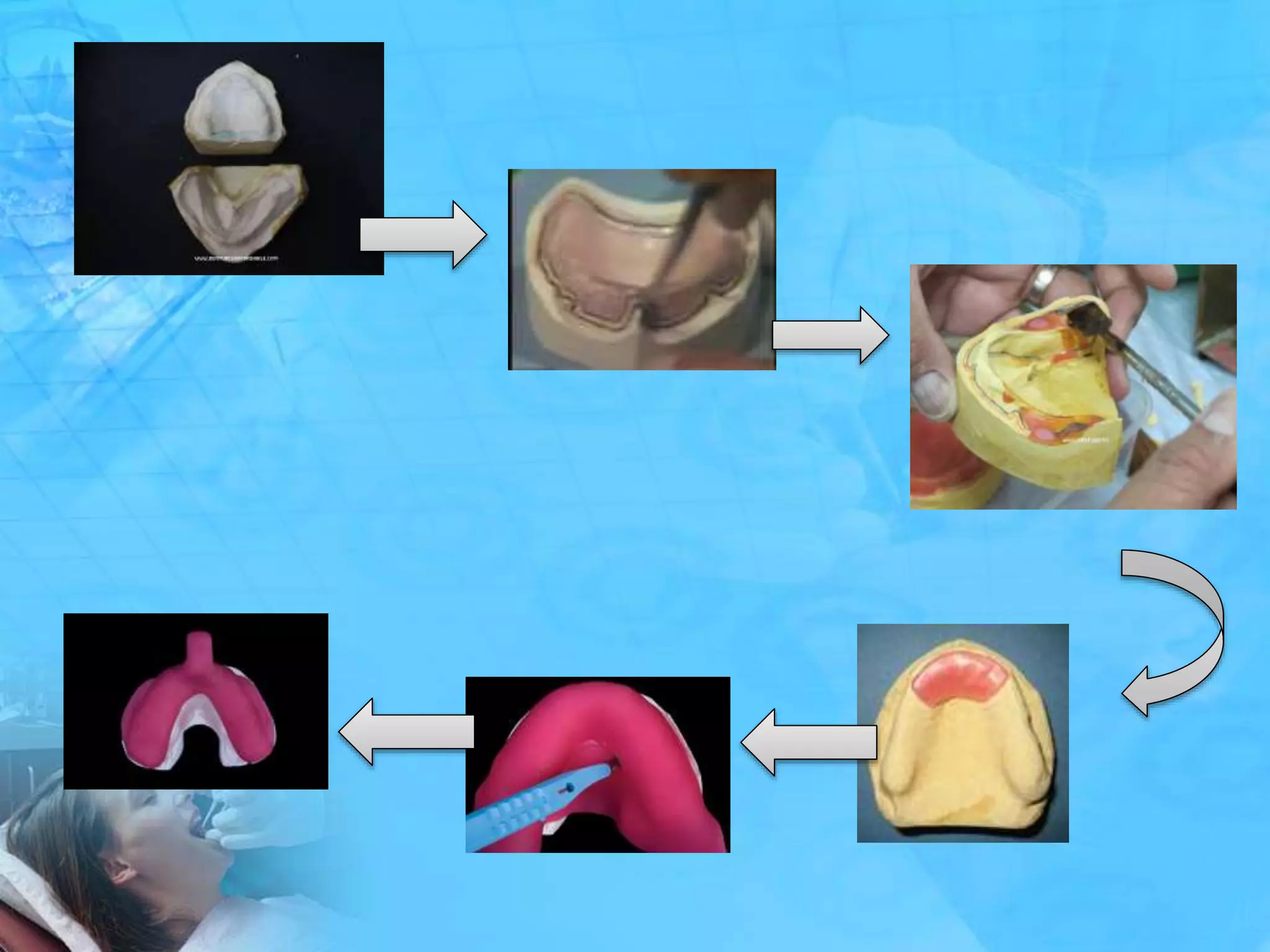 laboratory procedures in make of complete denture | PPTX