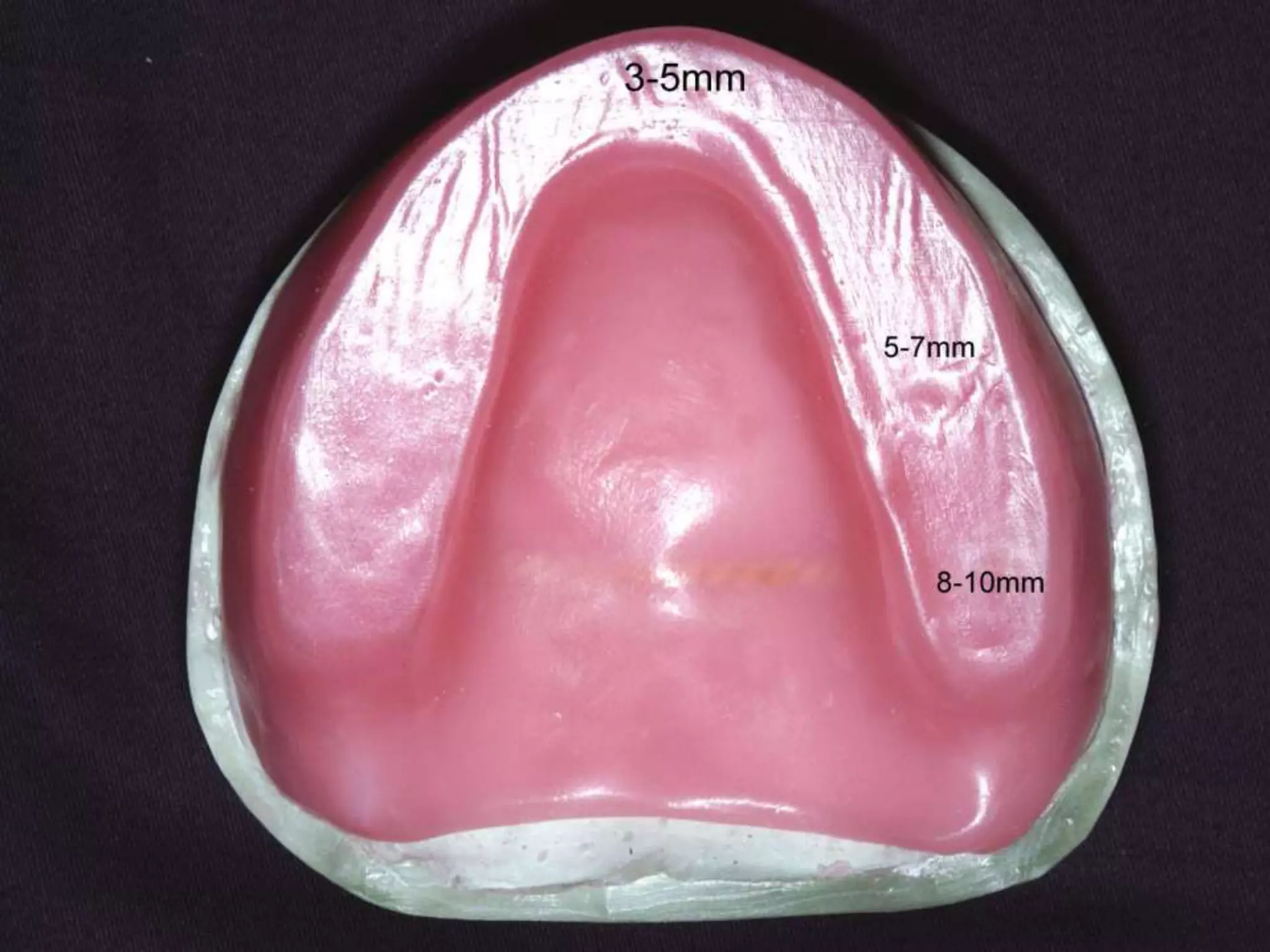 laboratory procedures in make of complete denture | PPTX