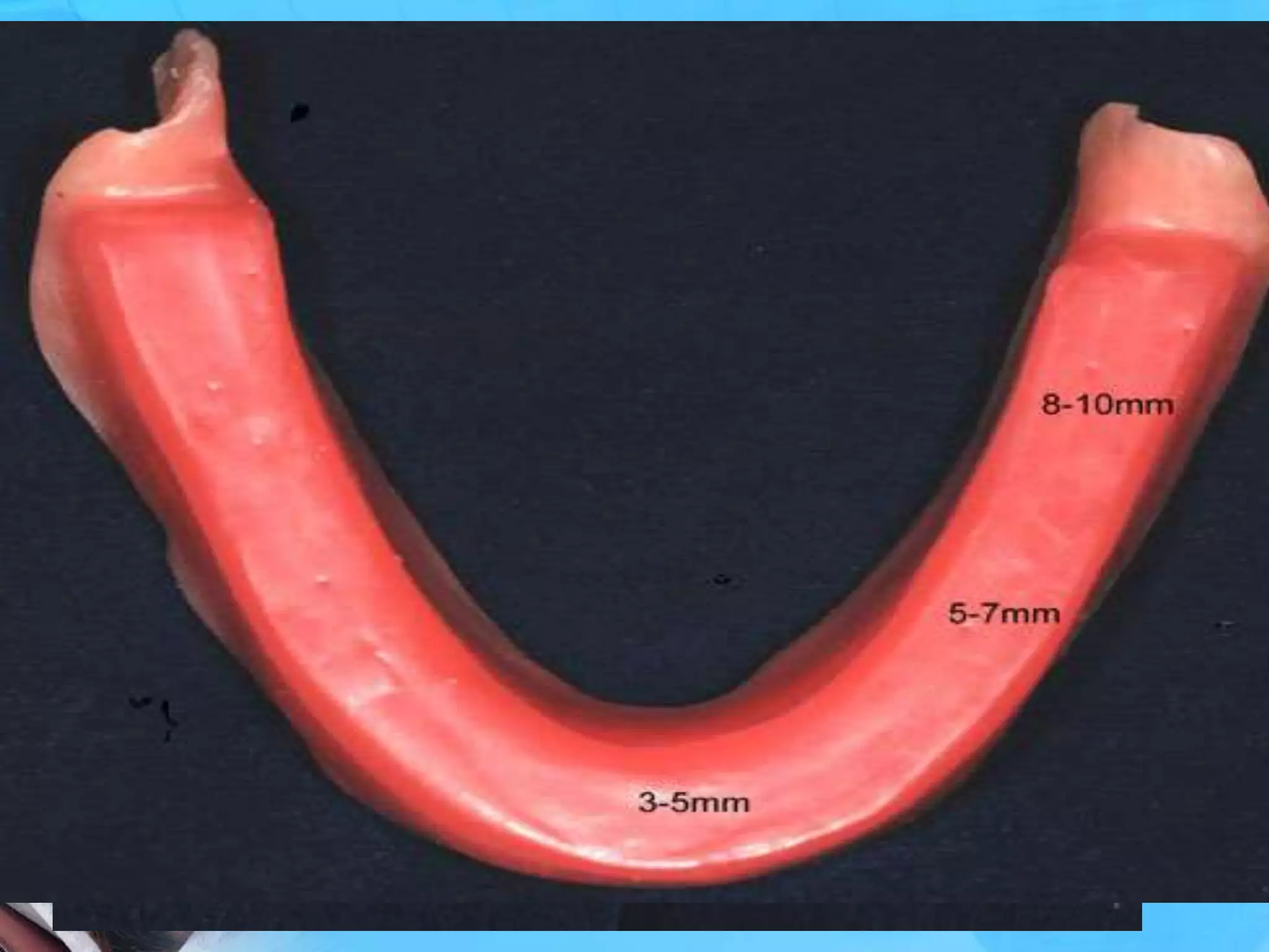 laboratory procedures in make of complete denture | PPTX