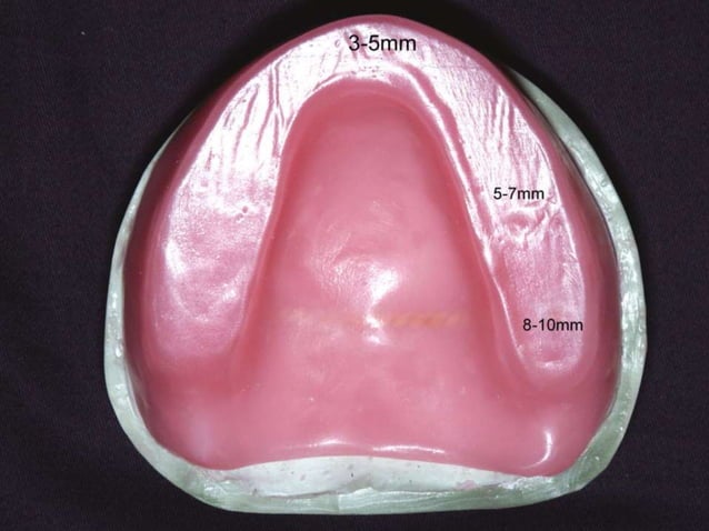 laboratory procedures in make of complete denture | PPTX