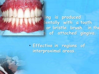 laboratory procedures in make of complete denture | PPTX