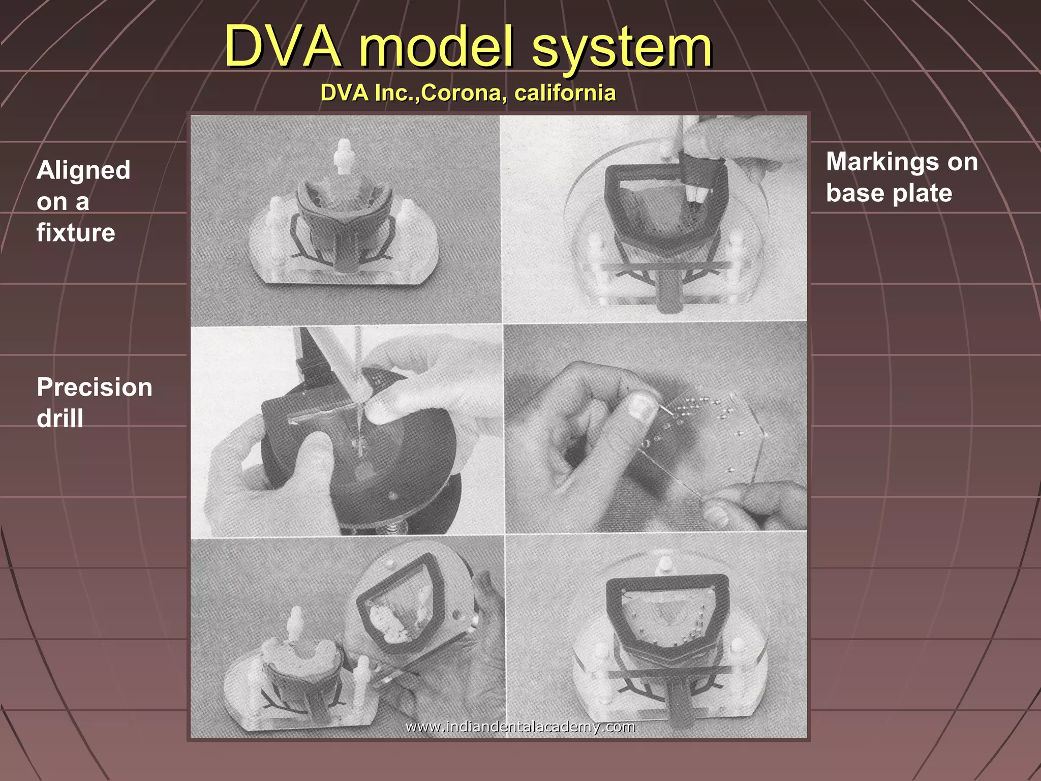 Laboratory procedures in fpd/cosmetic dentistry courses | PPT