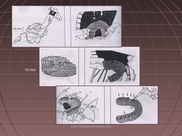 Laboratory procedures in fpd/cosmetic dentistry courses | PPT | Dental ...