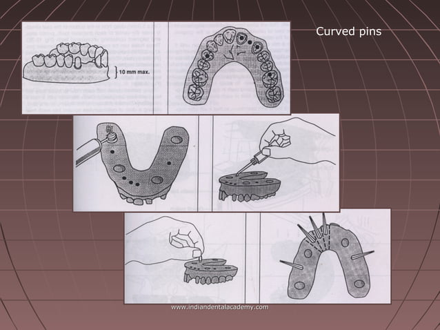 Laboratory procedures in fpd/cosmetic dentistry courses | PPT | Dental ...