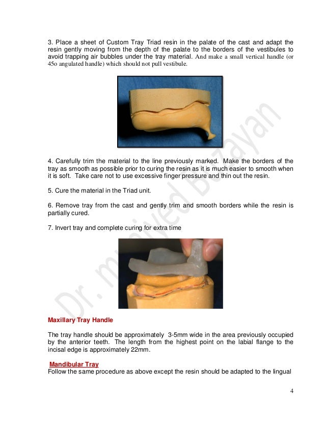 Laboratory procedures special tray construction lab