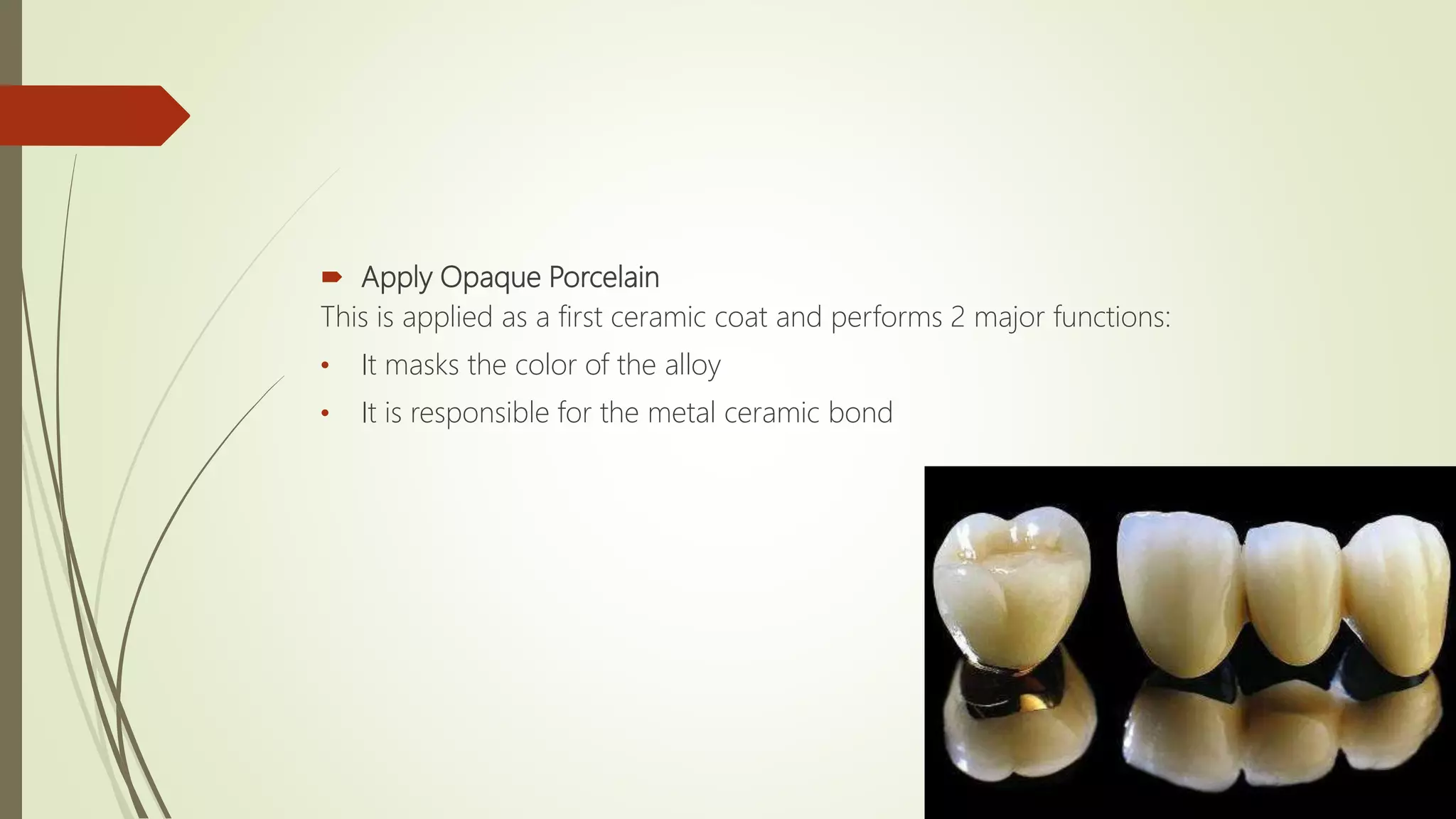 Laboratory steps of crown and bridge fabrication | PPTX