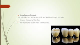 Laboratory steps of crown and bridge fabrication | PPTX
