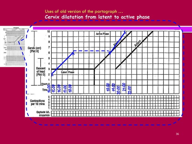 Labor management and detection using the partograph.pptx