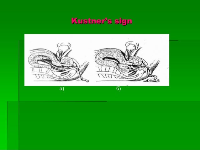 Physiology of labor. Anaesthesia in labor