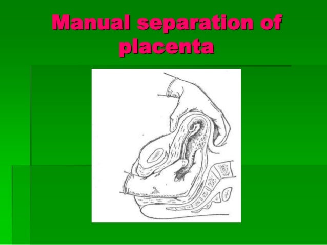 Physiology of labor. Anaesthesia in labor