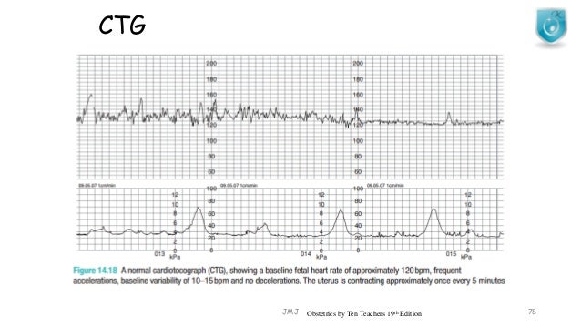 Normal Labour and Abnormal Labour