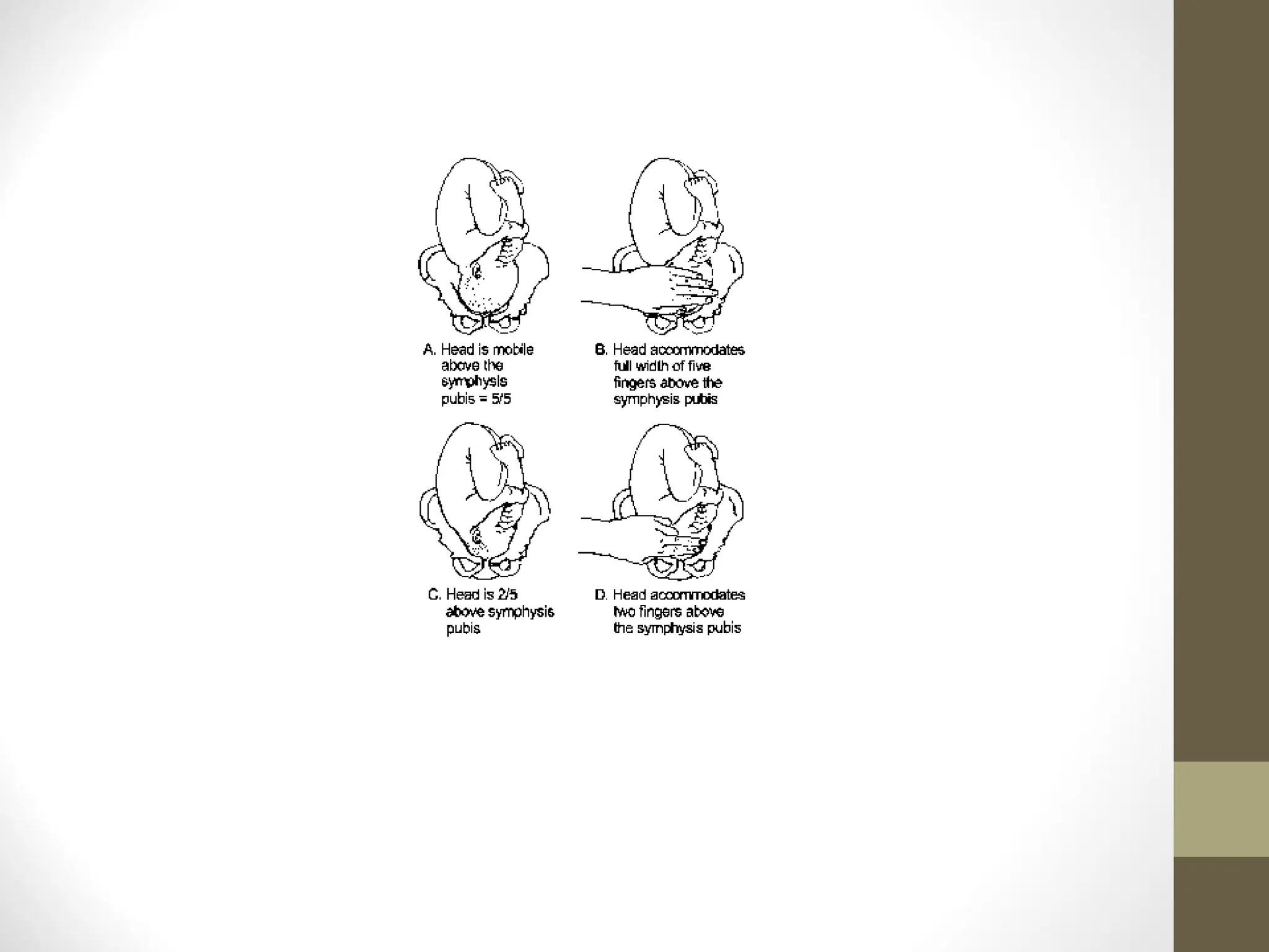 labour ,maternal boney pelvis and fetal head | PPT