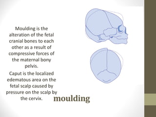 labour ,maternal boney pelvis and fetal head | PPT