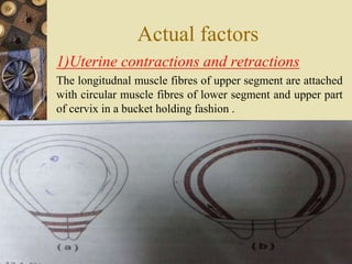 Labour 1st stage | PPTX