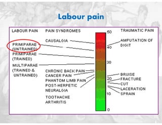 Labour Analgesia and pain free Labour anasthesia | PDF
