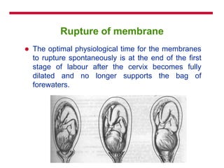 Labour and its stages | PPTX