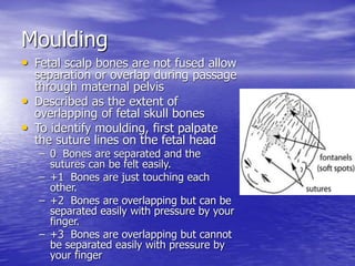 Labour and partogram.ppt