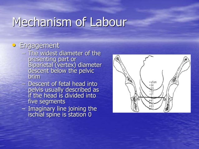 Labour and partogram.ppt