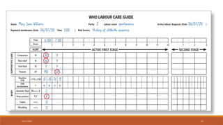 labour care guide ppt .pptx labour care guide ppt .pptx