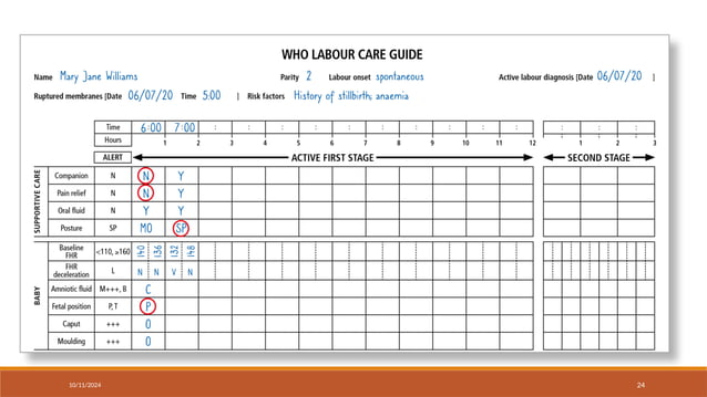 labour care guide ppt .pptx labour care guide ppt .pptx