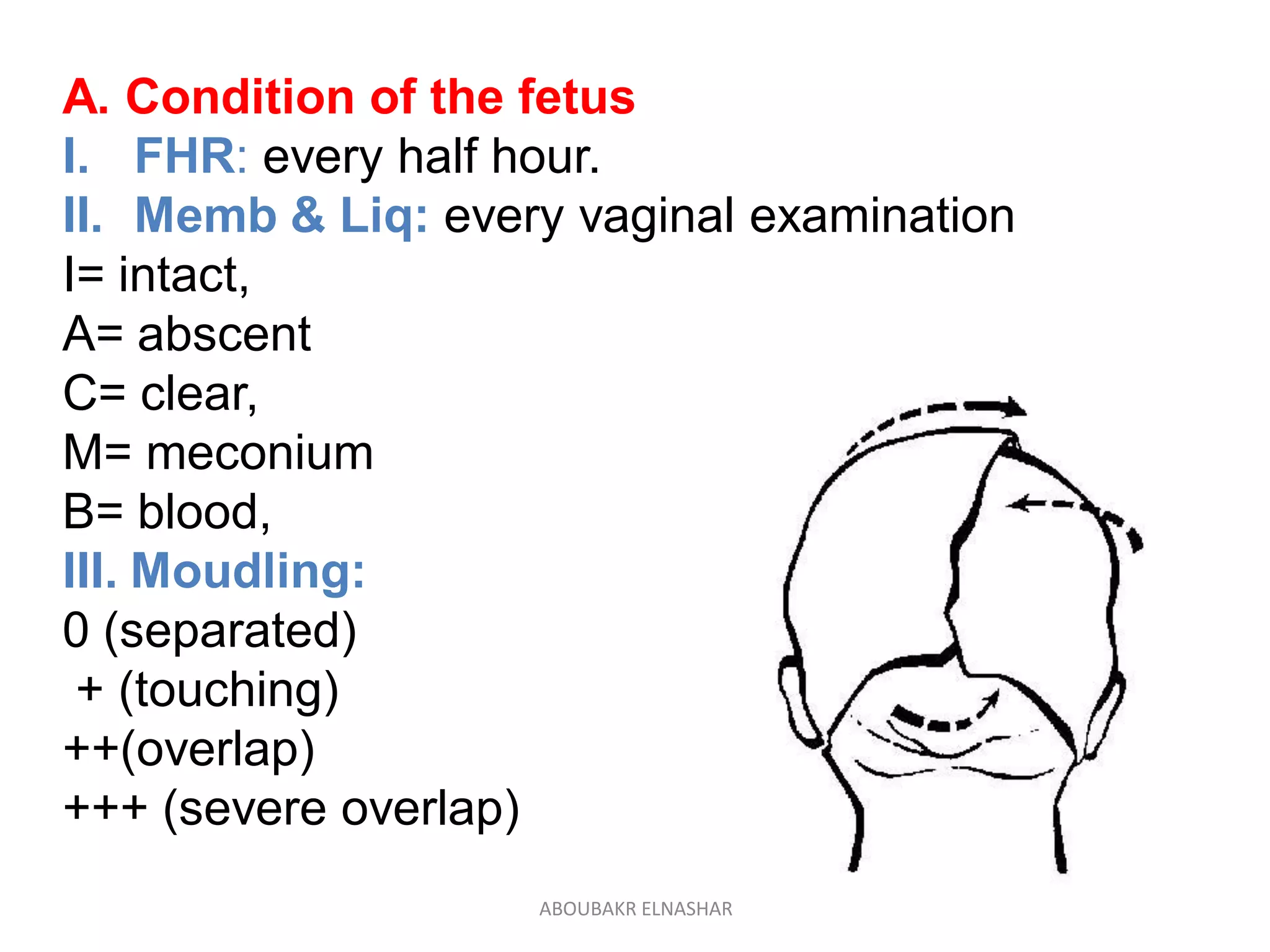 Management of normal labour | PDF