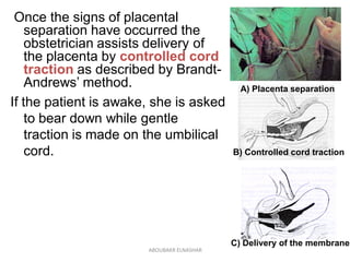 Management of normal labour | PPT