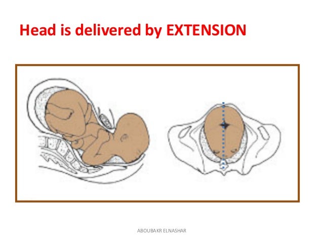 Management of normal labour