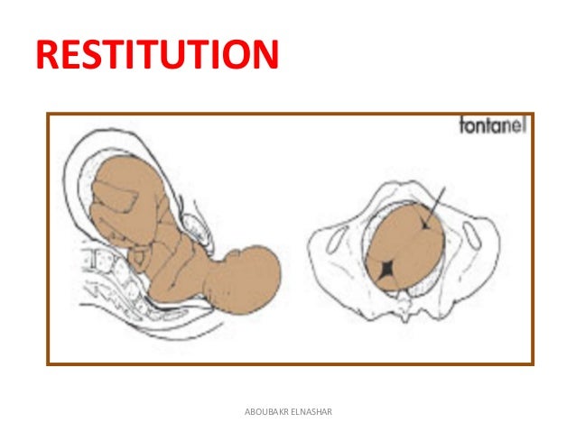 Management of normal labour