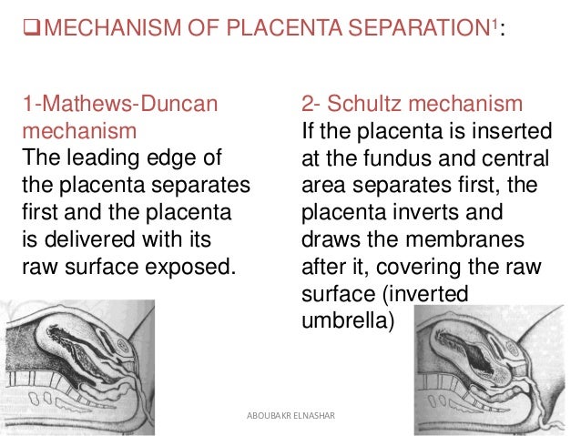 Management of normal labour