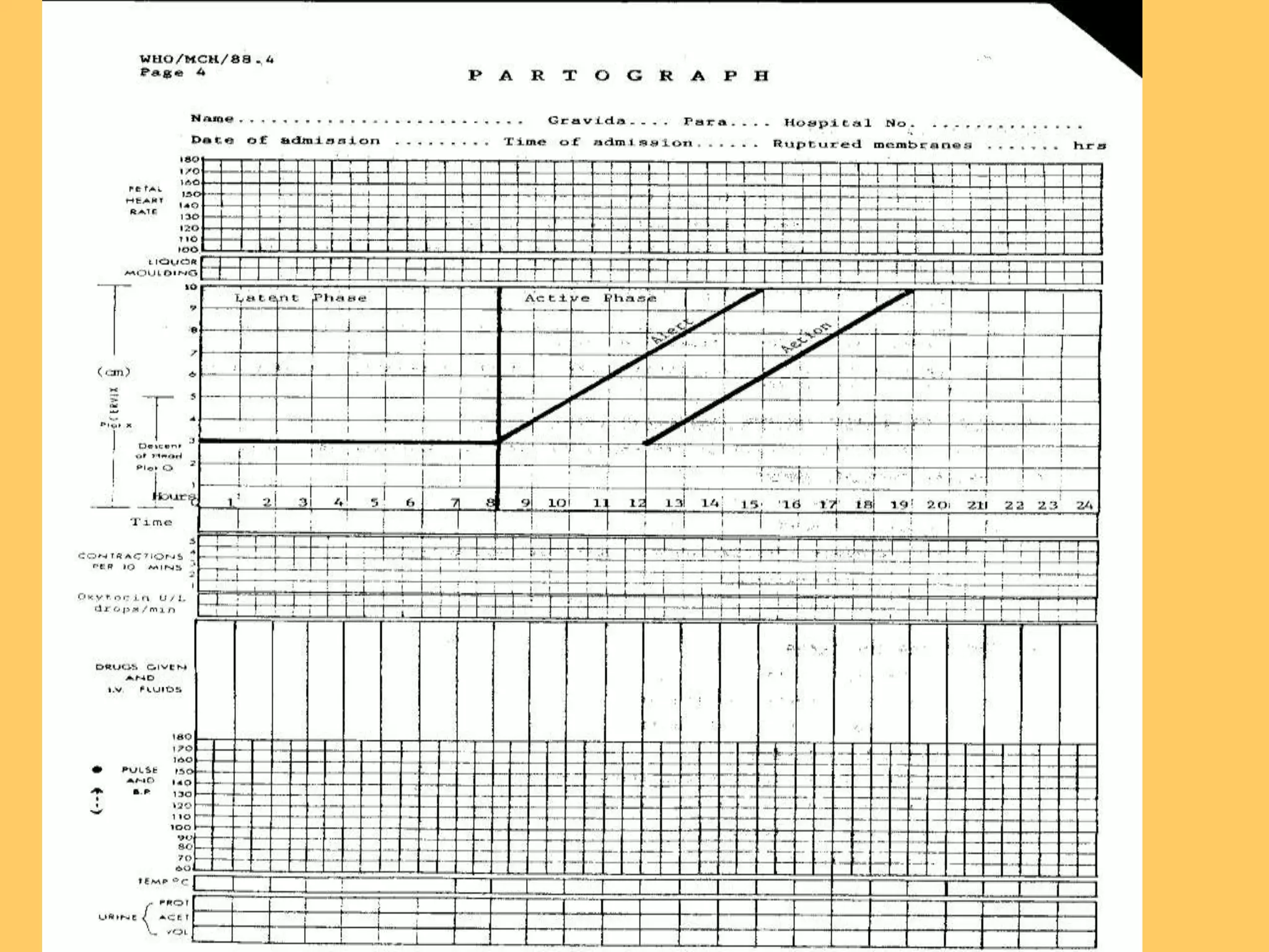 Dysfunctional Labour & Partograph | PPTX