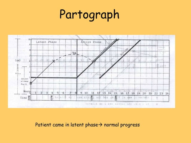 Dysfunctional Labour & Partograph | PPTX
