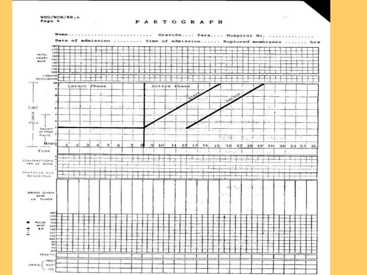 Dysfunctional Labour And Partograph