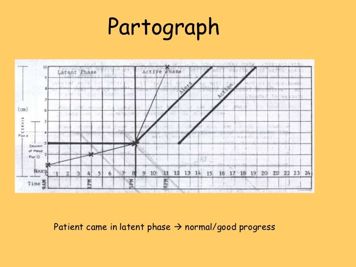 Dysfunctional Labour And Partograph