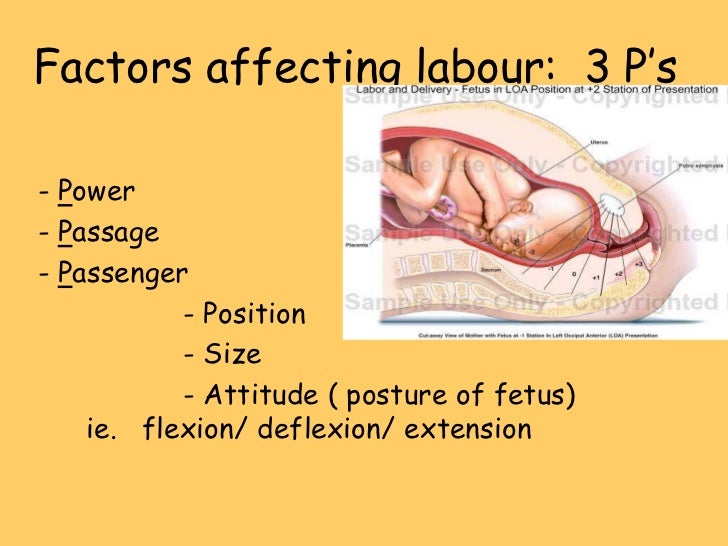 Dysfunctional Labour And Partograph