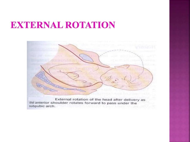 Mechanism of labour | PPT