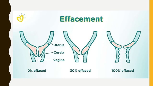 Labour, Stages and its Physiology in obg | PPT | Pregnancy ...
