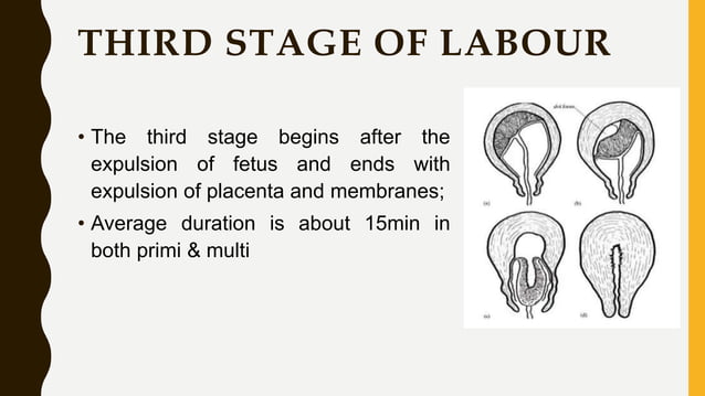 Labour, Stages and its Physiology in obg | PPT | Pregnancy ...