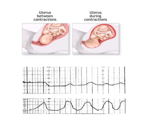 Labour tutorial | PPT