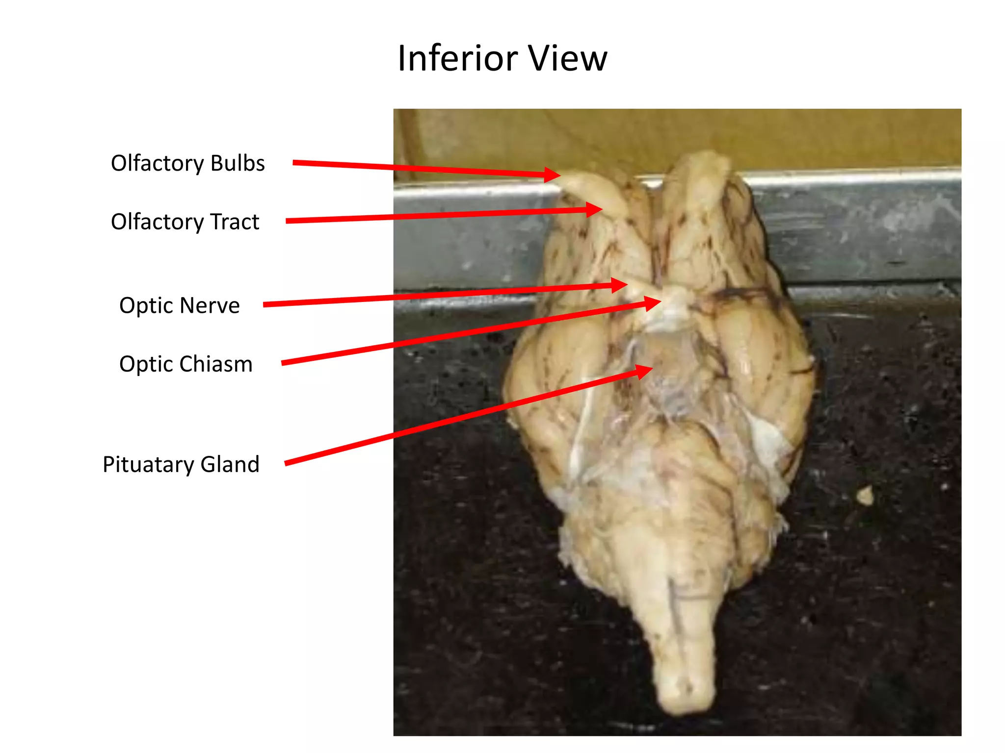 Lab Practical Iii | PPT