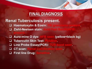 NON-PULMONARY TUBERCULOSIS(RENAL TB) | PPTX