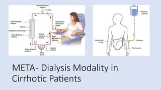 Peritonitis in Patients with liver disease and peritoneal dialysis | PPTX