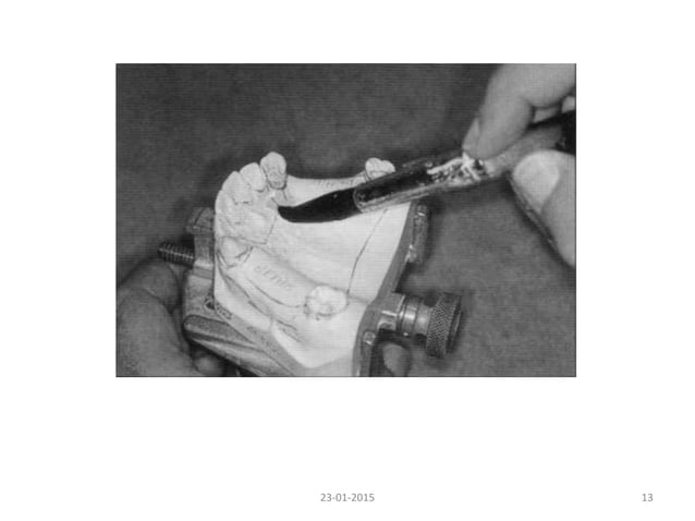 Lab procedure cast partial | PPTX