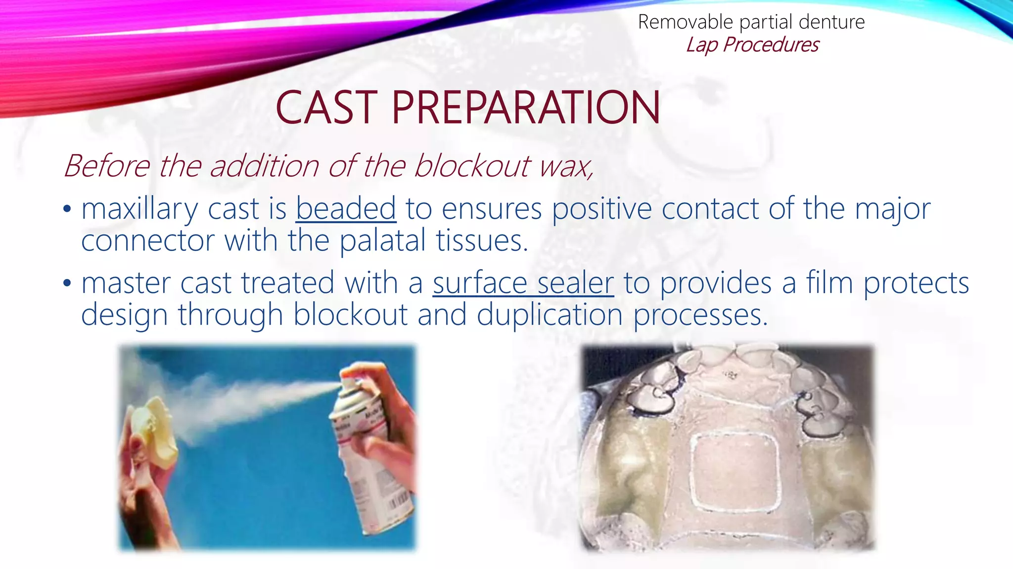 Lab steps of partial denture framework construction | PPTX