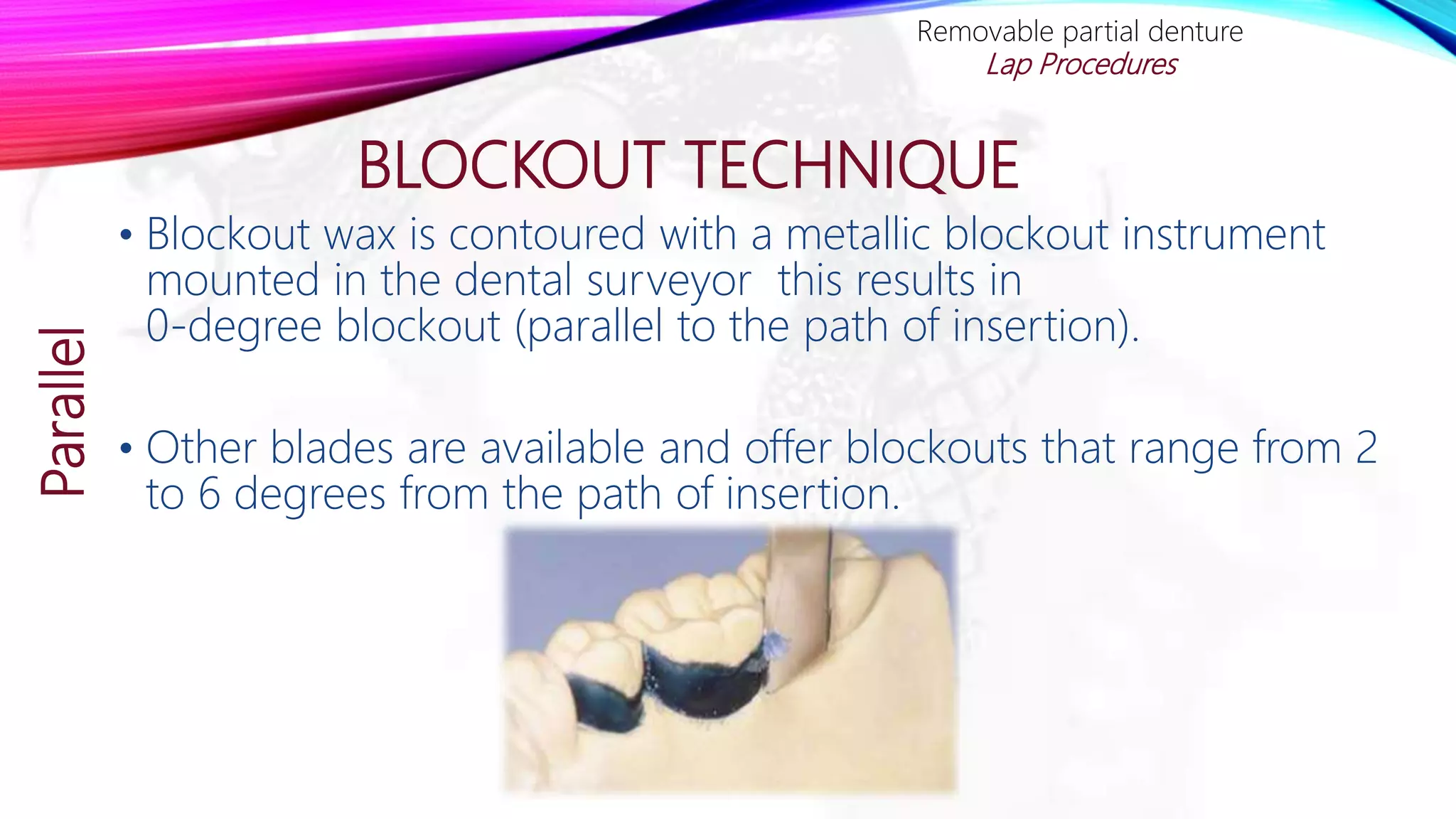 Lab steps of partial denture framework construction | PPTX