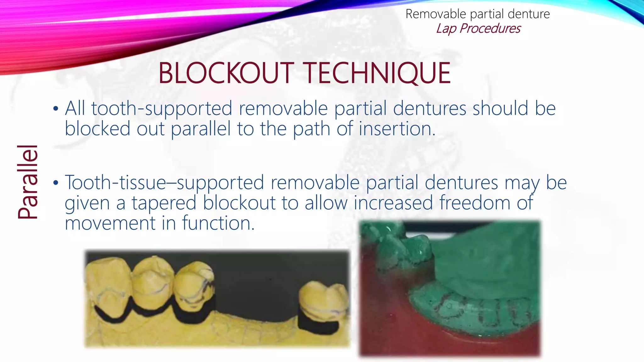 Lab steps of partial denture framework construction | PPTX