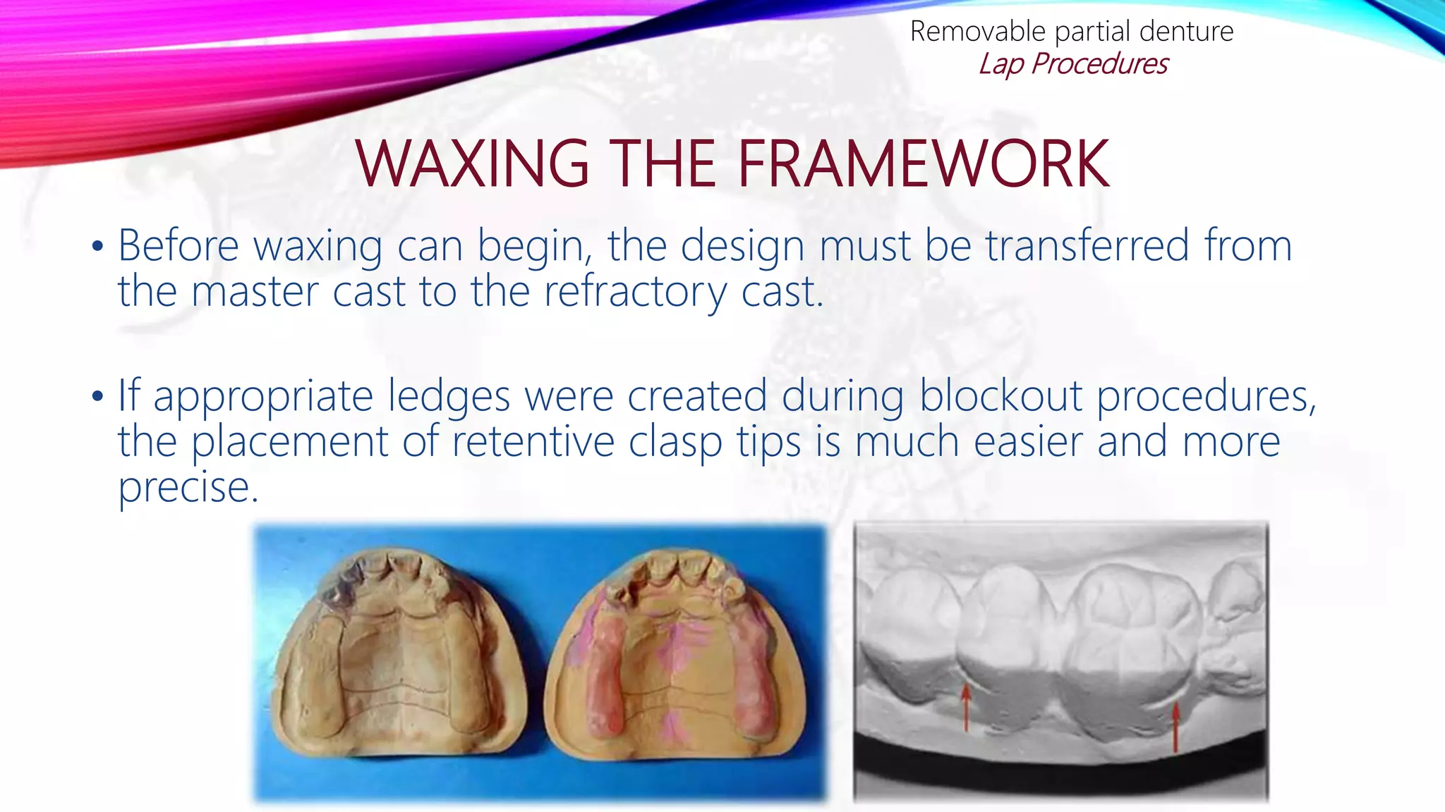 Lab steps of partial denture framework construction | PPTX