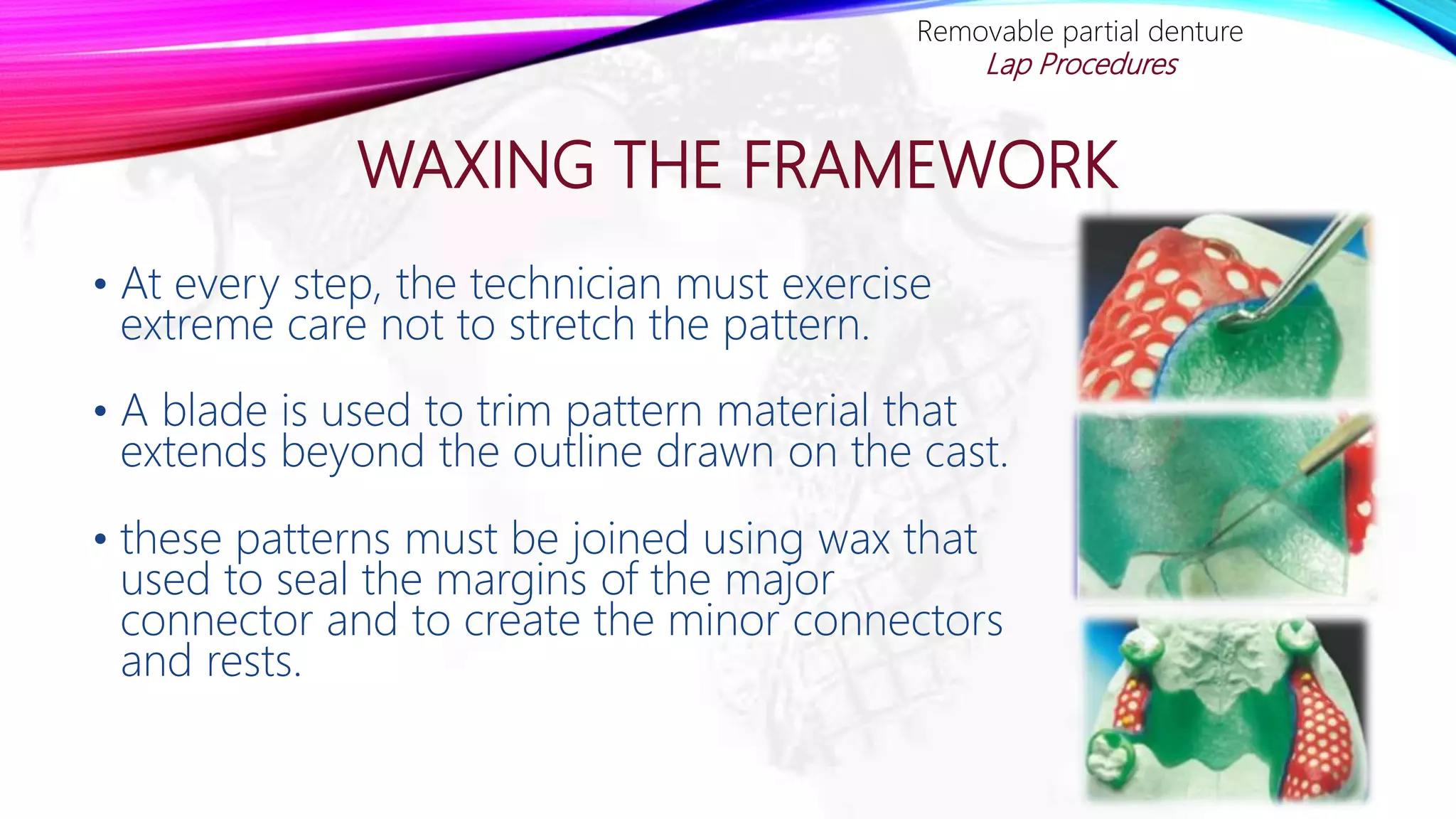 Lab steps of partial denture framework construction | PPTX