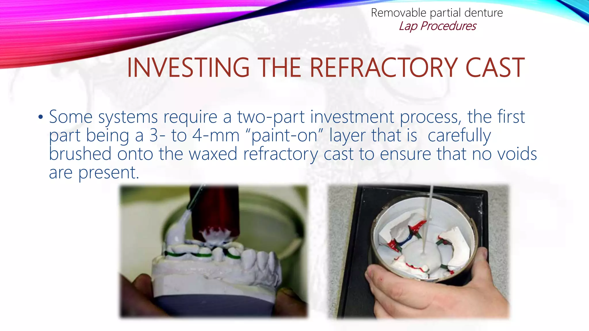 Lab steps of partial denture framework construction | PPTX